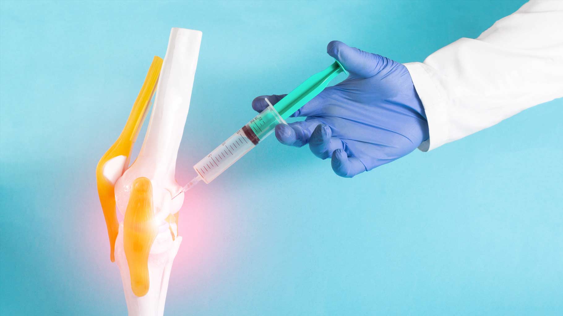 What is the Success Rate of Viscosupplementation? - Joint Relief Institute